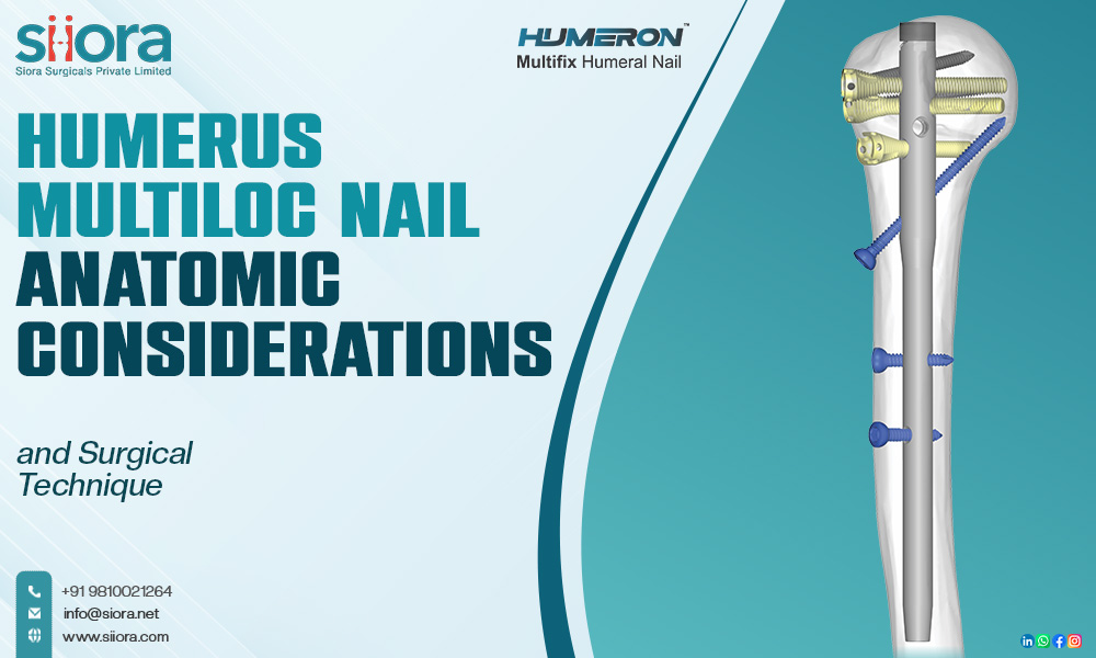 Humerus Multiloc Nail: Anatomy and Surgical Approach – Orthopedic Implants